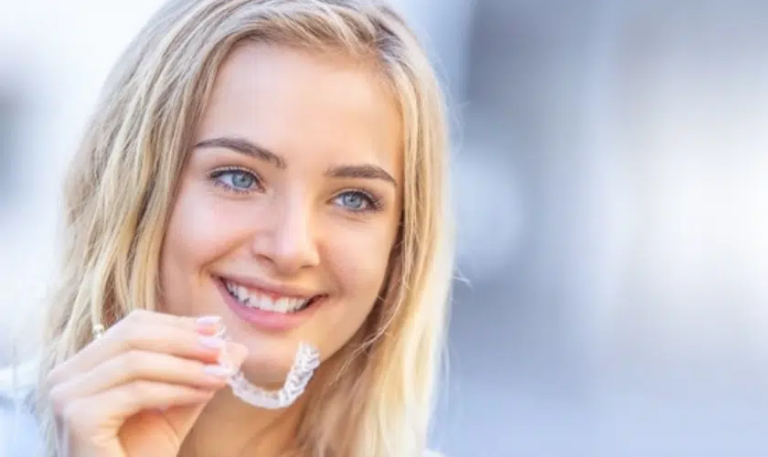 The Step-by-Step Process of Getting Invisalign Treatment